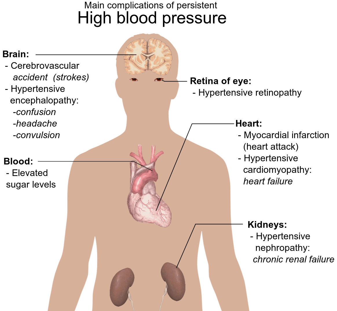 High Blood Pressure Hypertension Dr Thind s Homoeopathy High Blood Pressure Hypertension Dr Thind s Homoeopathy