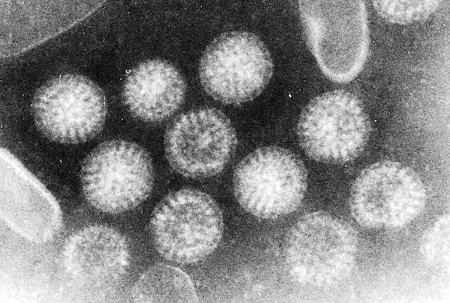 Rotavirus | Signs & Symptoms | Prevention | Dr. Thind's Homeopathy